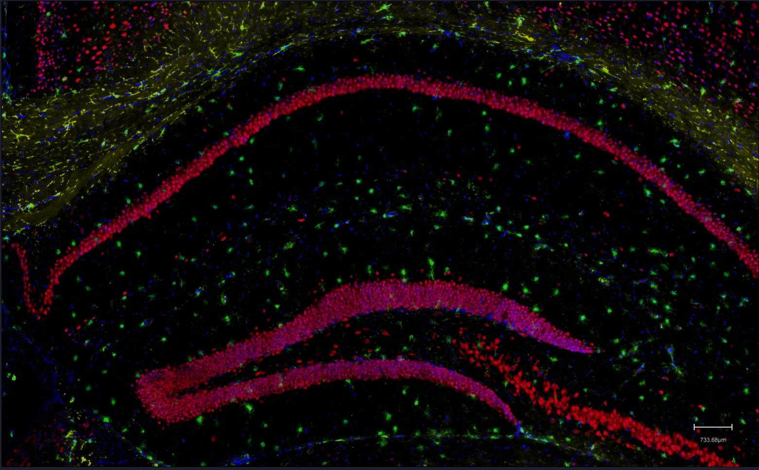 About Us Aspect Analytics Bring Your Spatial Multi Omics Data Together